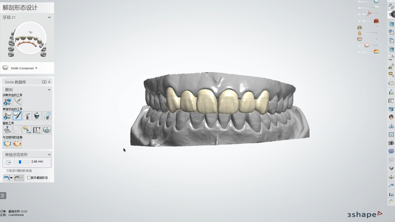 数字化口腔牙齿3shape形态课必备教程17讲_医疗器具_诊断治疗_3Shape_口腔-仿真秀视频课程
