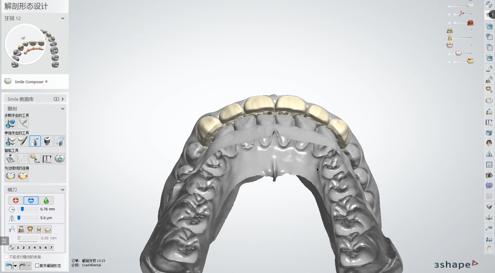 数字化口腔牙齿3shape形态课必备教程17讲_医疗器具_诊断治疗_3Shape_口腔-仿真秀视频课程