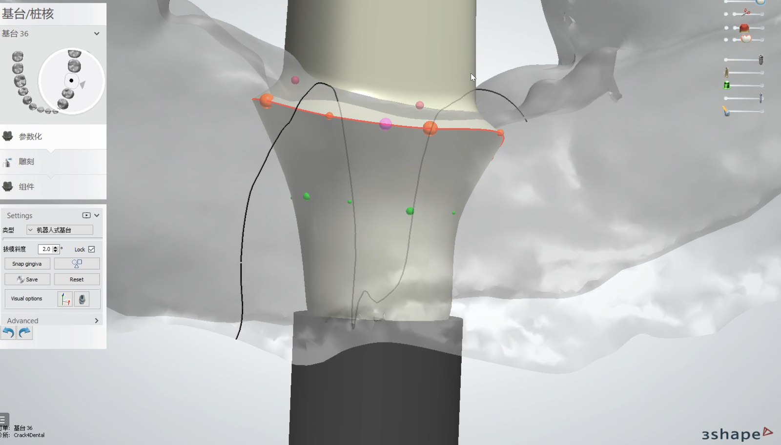 3shape种植课必备教程10讲_医疗器具_诊断治疗_3Shape_口腔-仿真秀视频课程